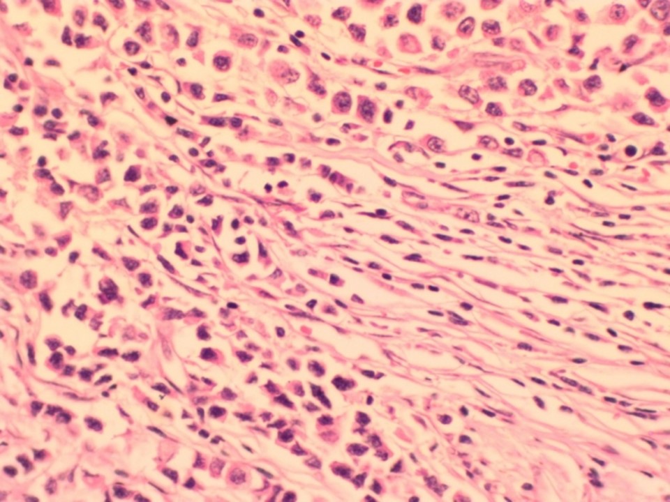 Atlas Of Breast Cancer Early Detection Atlas Of Breast Cancer Early Detection