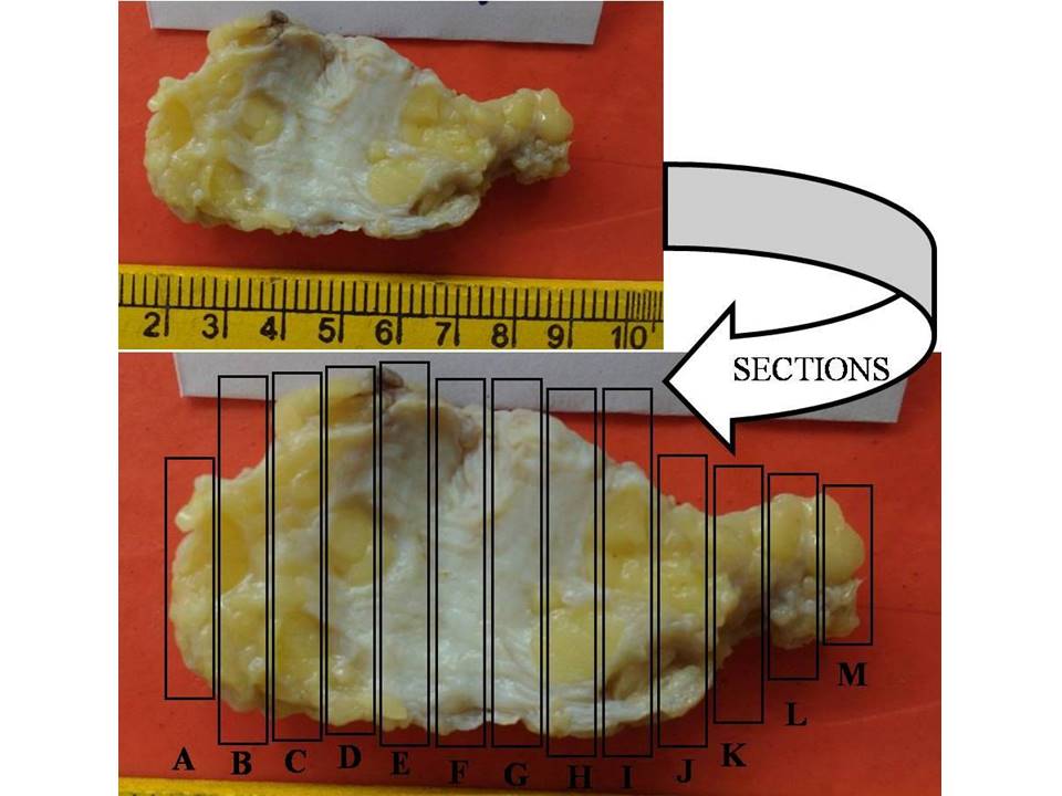 Atlas of breast cancer early detection