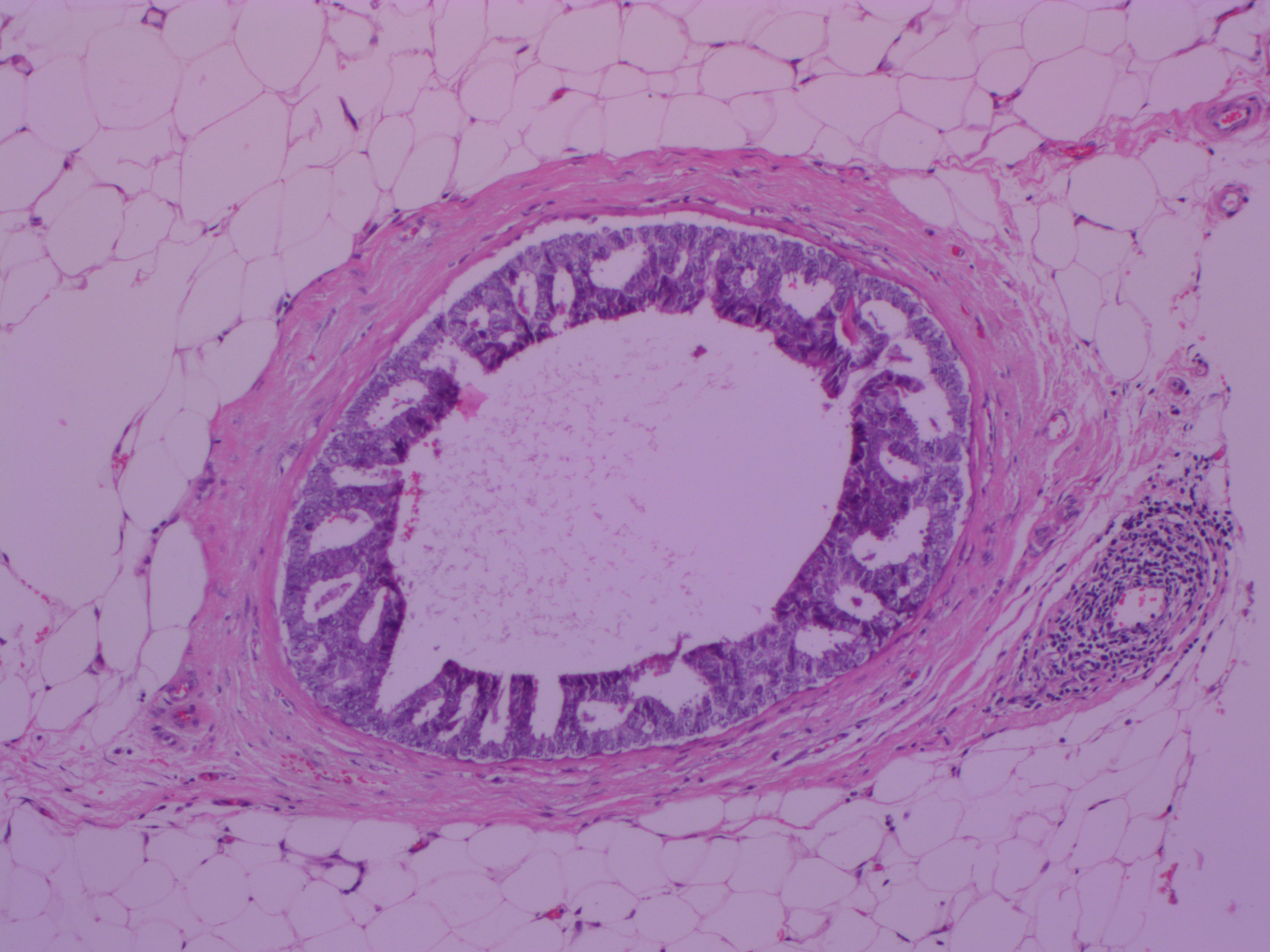 Atlas of breast cancer early detection