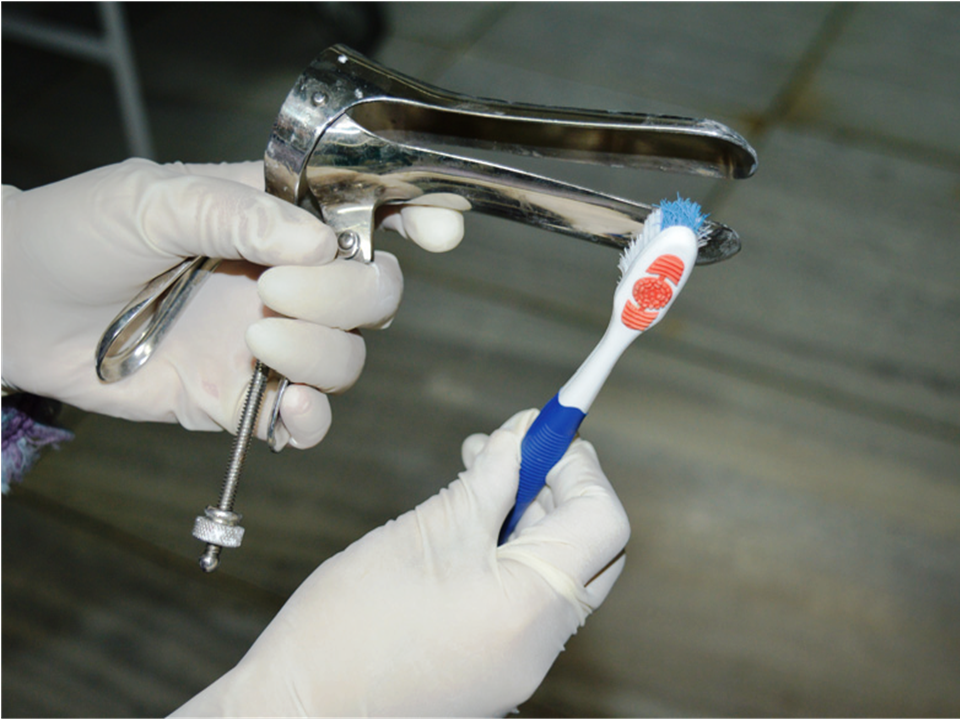 Using HPV tests for cervical cancer screening and managing HPV-positive ...