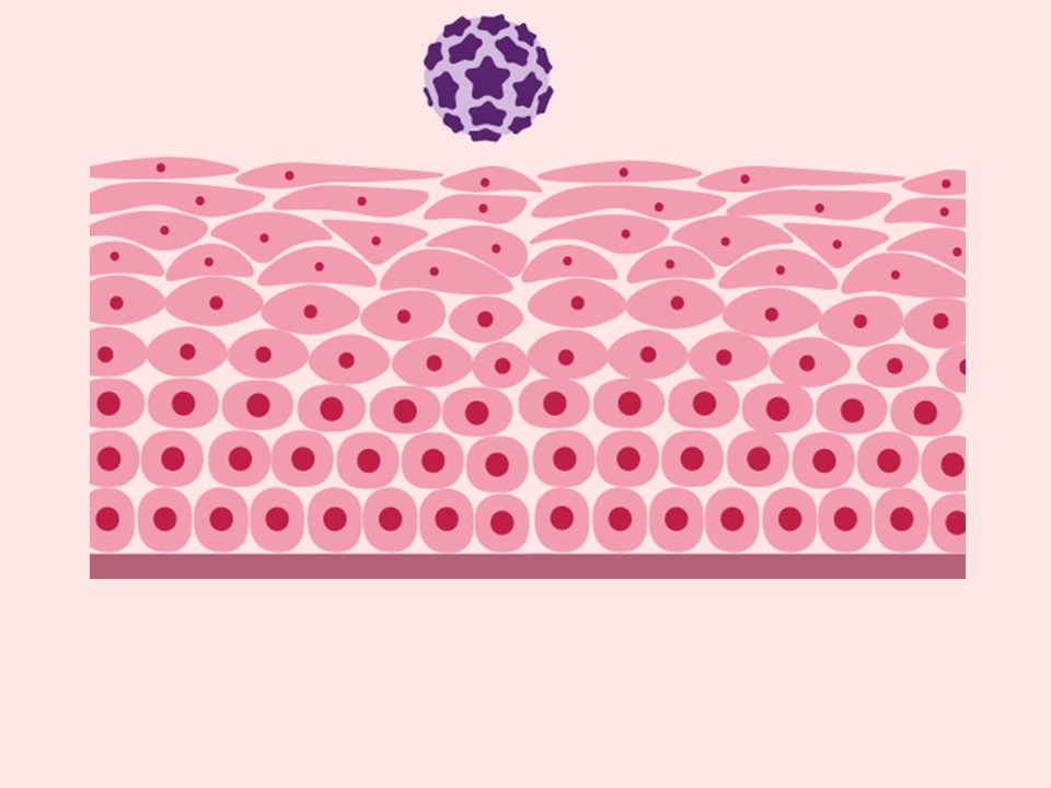Using HPV tests for cervical cancer screening and managing HPV-positive ...