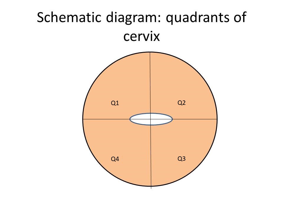 Atlas of visual inspection of the cervix with acetic acid for screening ...