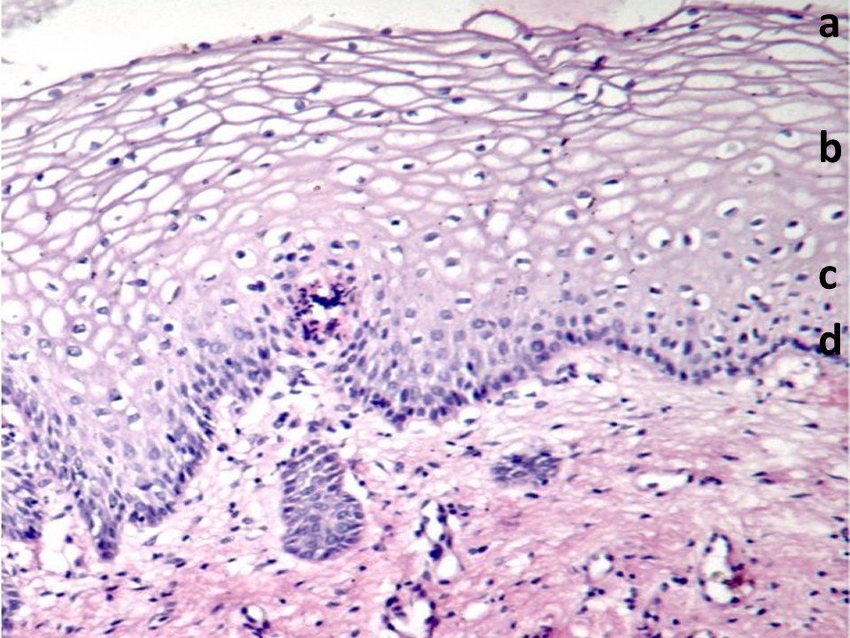 Atlas of visual inspection of the cervix with acetic acid for screening ...