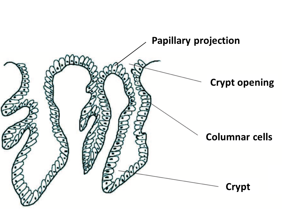 Atlas of visual inspection of the cervix with acetic acid for screening ...