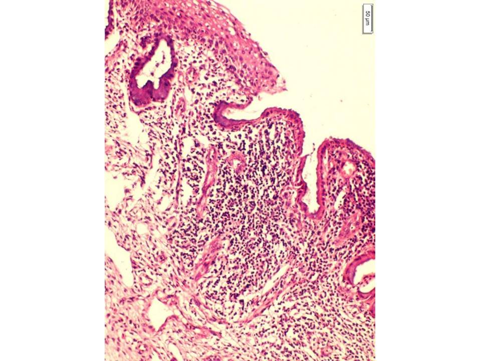 Atlas of visual inspection of the cervix with acetic acid for screening ...